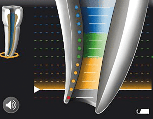 VDW RAYPEX 6 Apexlokator - Meditec Germany